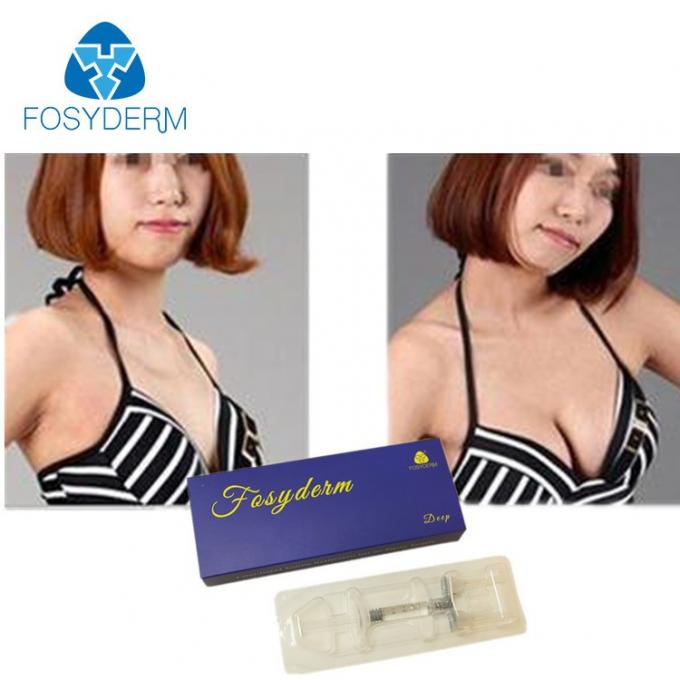 Safety Hyaluronic Acid Lip Fillers 2ml , Lip Plumping Injections Dermal Filler