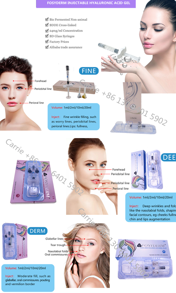 2ml Injectable BDDE Cross Linking Hyaluronic Acid Filler Injection For Lip Volume