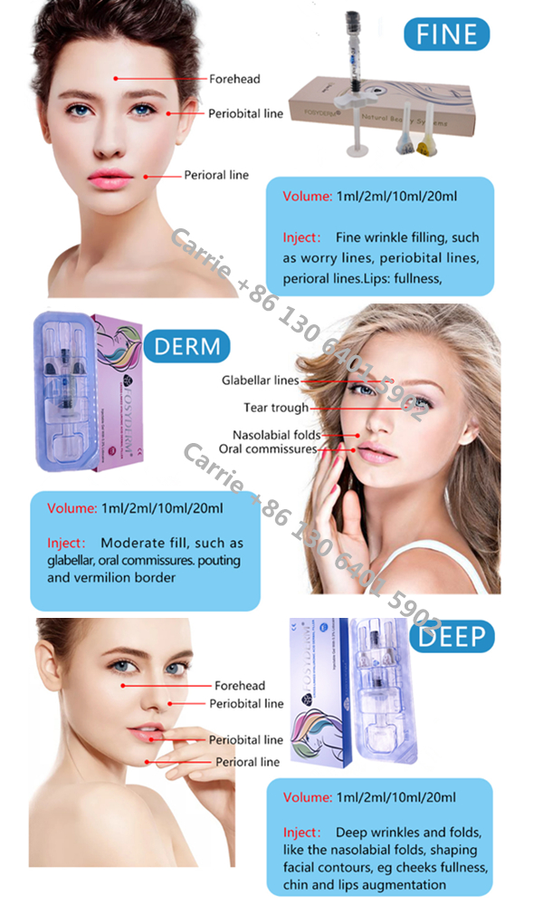 Skin Care 1ml Fine Dermal Eye Lip Plla Dermal Filler Brands Injection