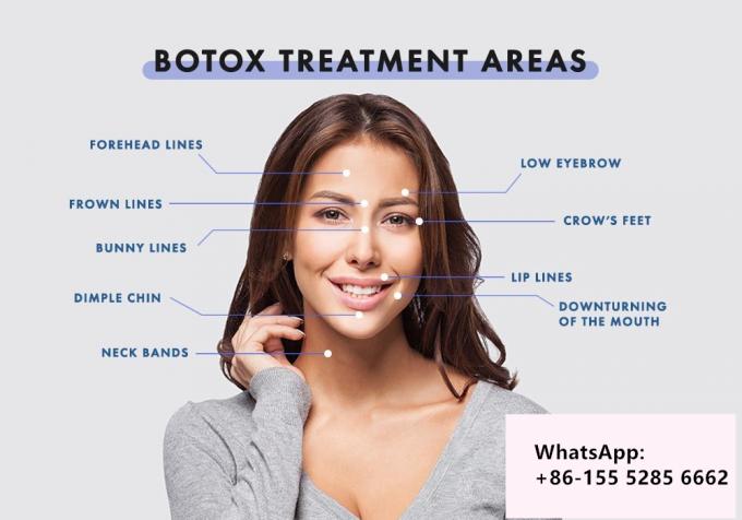 100 Allergan Units Botulinum Toxin Anti Aging Injection