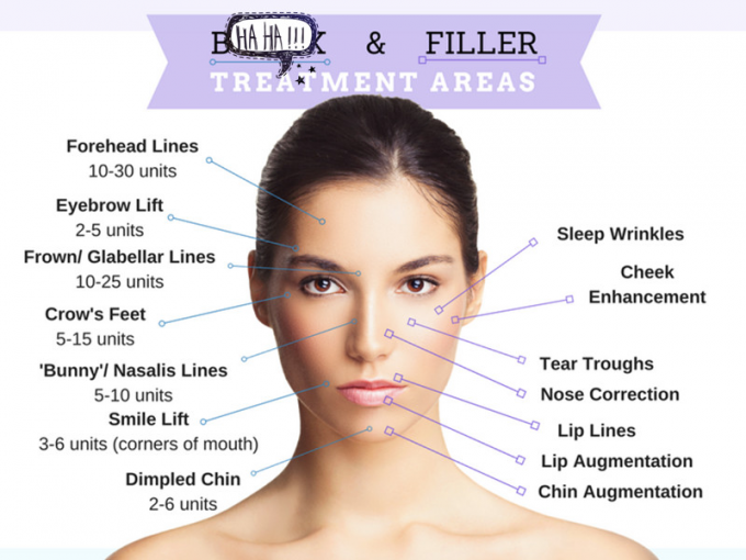 Allergan Injection Botulinum Toxin 100 Units Forehead Wrinkles