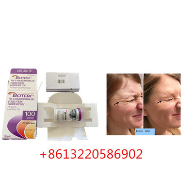 Anti Aging Allergan Botox Injection 100units Type A Anti Wrinkle