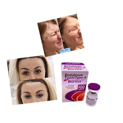 Dermal Filler Anti Wrinkle Allergan Botox 100 Units Botulinum Powder ...