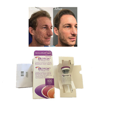 Allergan Botox 100 Units Types Botulinum Toxin Injection Anti Wrinkles