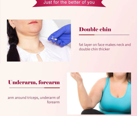 Efficient Lipolysis Injection Fat dissolving injection Liquid