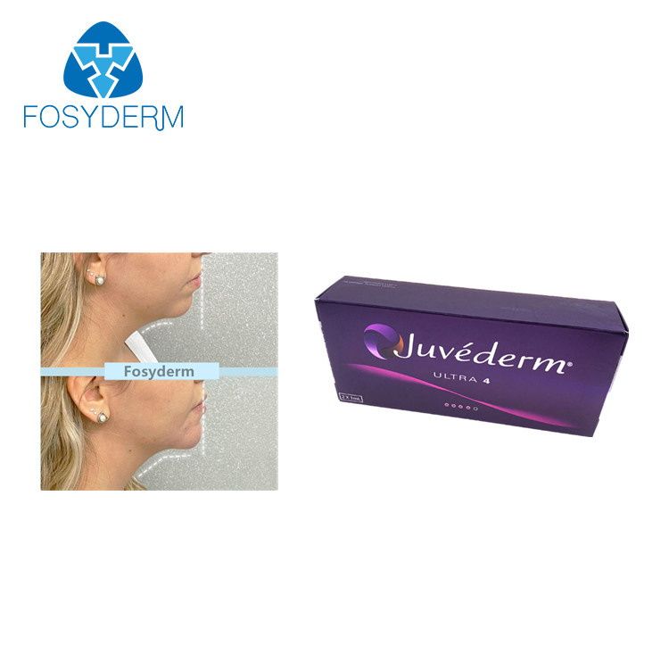 Chin Augmentation Cross Linked Juvederm Ultra4 Dermal Filler HA Injection