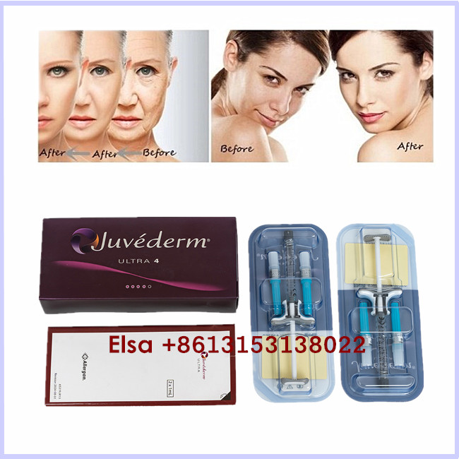 Aesthetic Products Juvederm Ultra3 Ultra4 Voluma Hyaluronic Acid Dermal Filler Gel Injection