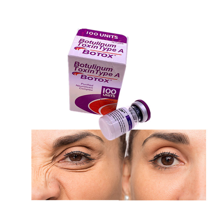 Removing Facial Lines Botulinum Toxin 100 Units Allergan o