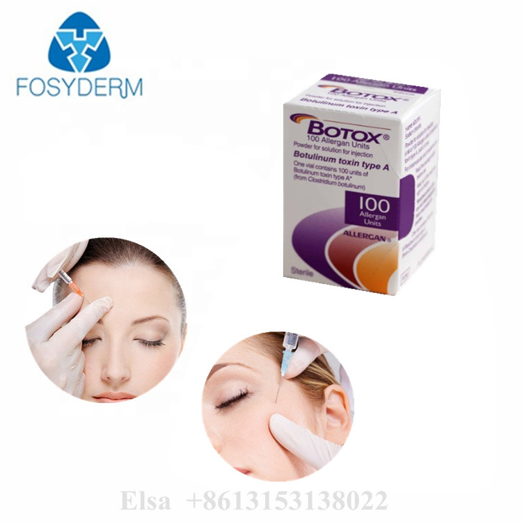 Injectable Allergan Botulinum Toxin Wrinkles Removal 100iu Btx White Powder