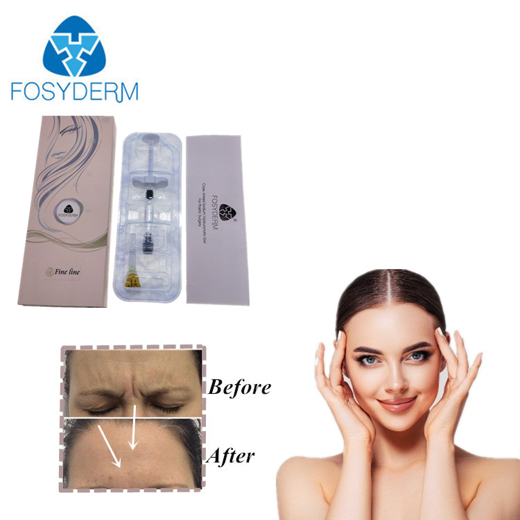 Facial Hyaluronic Acid Dermal Filler Lip Enhancer Ha Injection