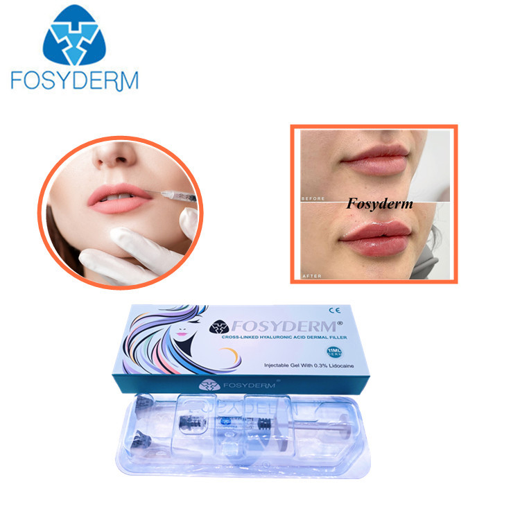 1.1 ml Derm Line Hyaluronic Acid Injectable Dermal Filler Lip Enhancement