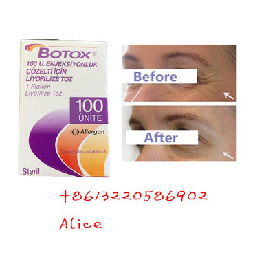 Allergan Botox Anti Aging Injection 100units Type A Anti Wrinkle